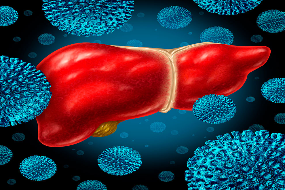Cáncer de hígado