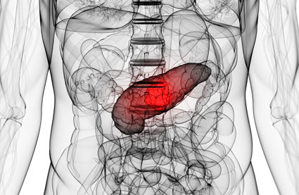 Cáncer de páncreas