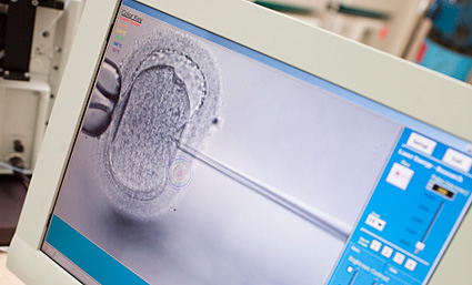 Inyección intracitoplasmática de espermatozoides (ICSI)