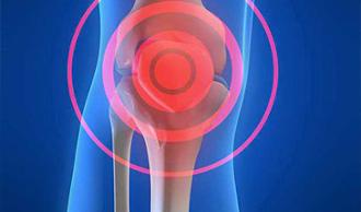 Lesión articular - Lesiones